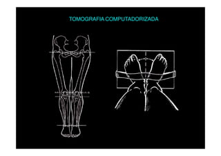 PROTOCOLO DE LYON EM TOMOGRAFIA COMPUTADORIZADA.pdf