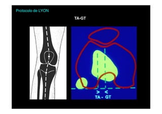 PROTOCOLO DE LYON EM TOMOGRAFIA COMPUTADORIZADA.pdf