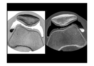 PROTOCOLO DE LYON EM TOMOGRAFIA COMPUTADORIZADA.pdf