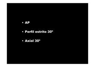 PROTOCOLO DE LYON EM TOMOGRAFIA COMPUTADORIZADA.pdf