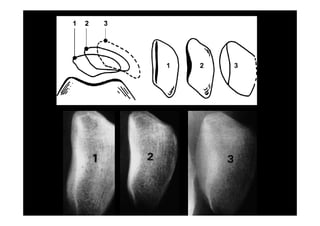 PROTOCOLO DE LYON EM TOMOGRAFIA COMPUTADORIZADA.pdf
