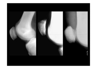 PROTOCOLO DE LYON EM TOMOGRAFIA COMPUTADORIZADA.pdf