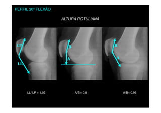 PROTOCOLO DE LYON EM TOMOGRAFIA COMPUTADORIZADA.pdf