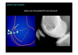 PROTOCOLO DE LYON EM TOMOGRAFIA COMPUTADORIZADA.pdf