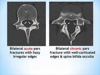Lysis repair a new surgical approach | PPT
