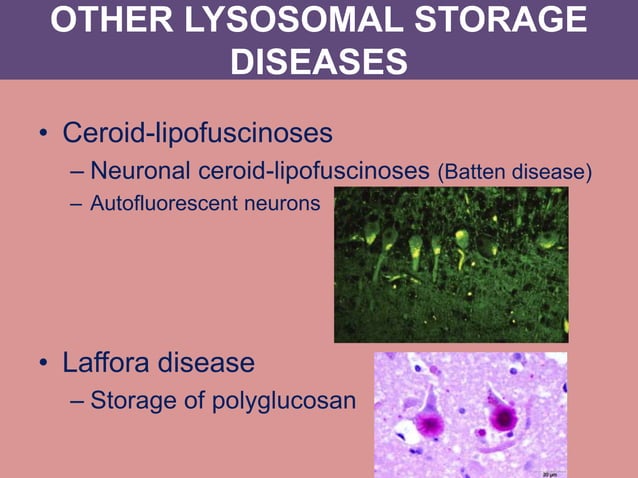 Lysosomal storage diseases | PPTX