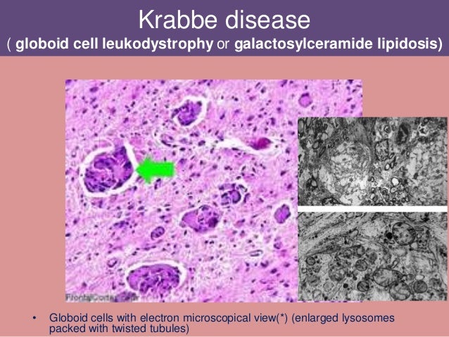 Lysosomal storage diseases