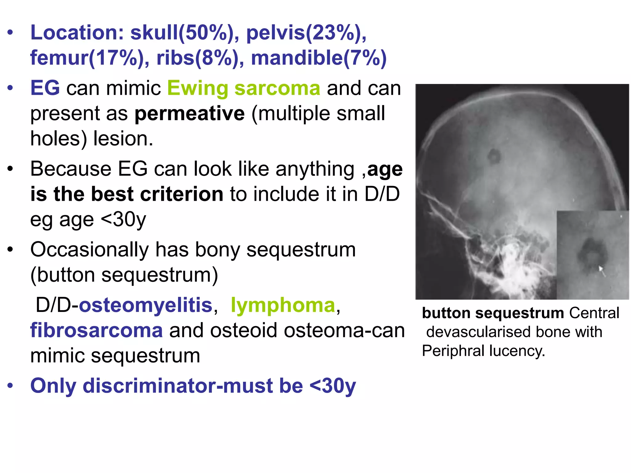 Lytic/cystic lesion of bone final | PPT