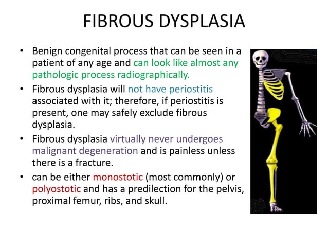Lytic lesions of bone | PPTX
