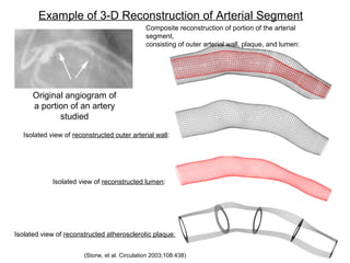 131 the evolution of coronary atherosclerosis | PPT