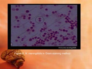 M.meningitis | PPT