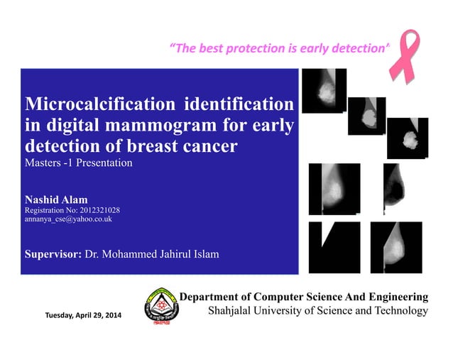 MICROCALCIFICATION IDENTIFICATION IN DIGITAL MAMMOGRAM FOR EARLY DETECTION OF BREAST CANCER | PPT