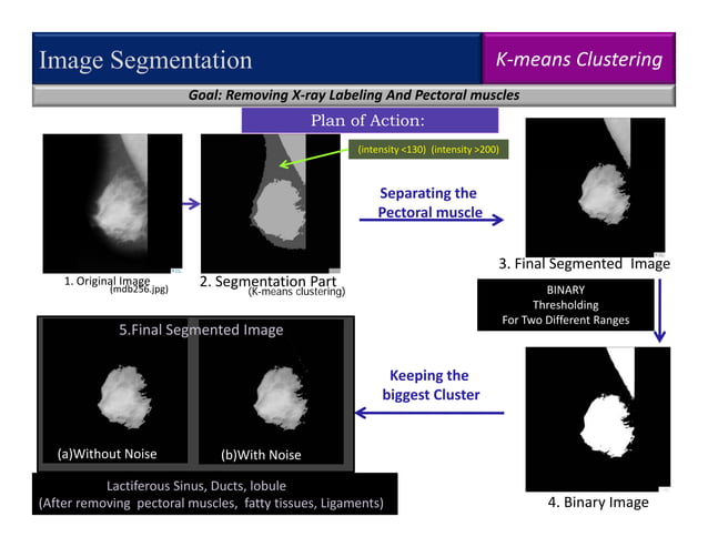 MICROCALCIFICATION IDENTIFICATION IN DIGITAL MAMMOGRAM FOR EARLY ...