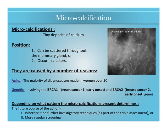 MICROCALCIFICATION IDENTIFICATION IN DIGITAL MAMMOGRAM FOR EARLY DETECTION OF BREAST CANCER | PPT