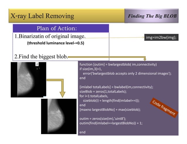 MICROCALCIFICATION IDENTIFICATION IN DIGITAL MAMMOGRAM FOR EARLY ...