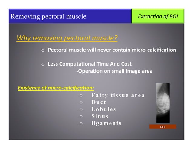 MICROCALCIFICATION IDENTIFICATION IN DIGITAL MAMMOGRAM FOR EARLY ...
