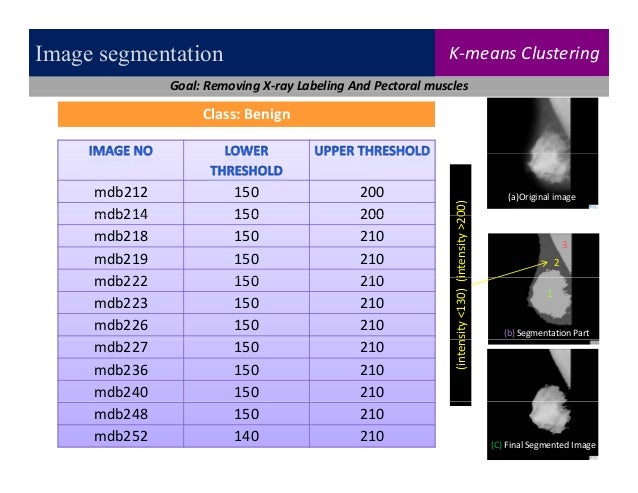 MICROCALCIFICATION IDENTIFICATION IN DIGITAL MAMMOGRAM FOR EARLY DETE…