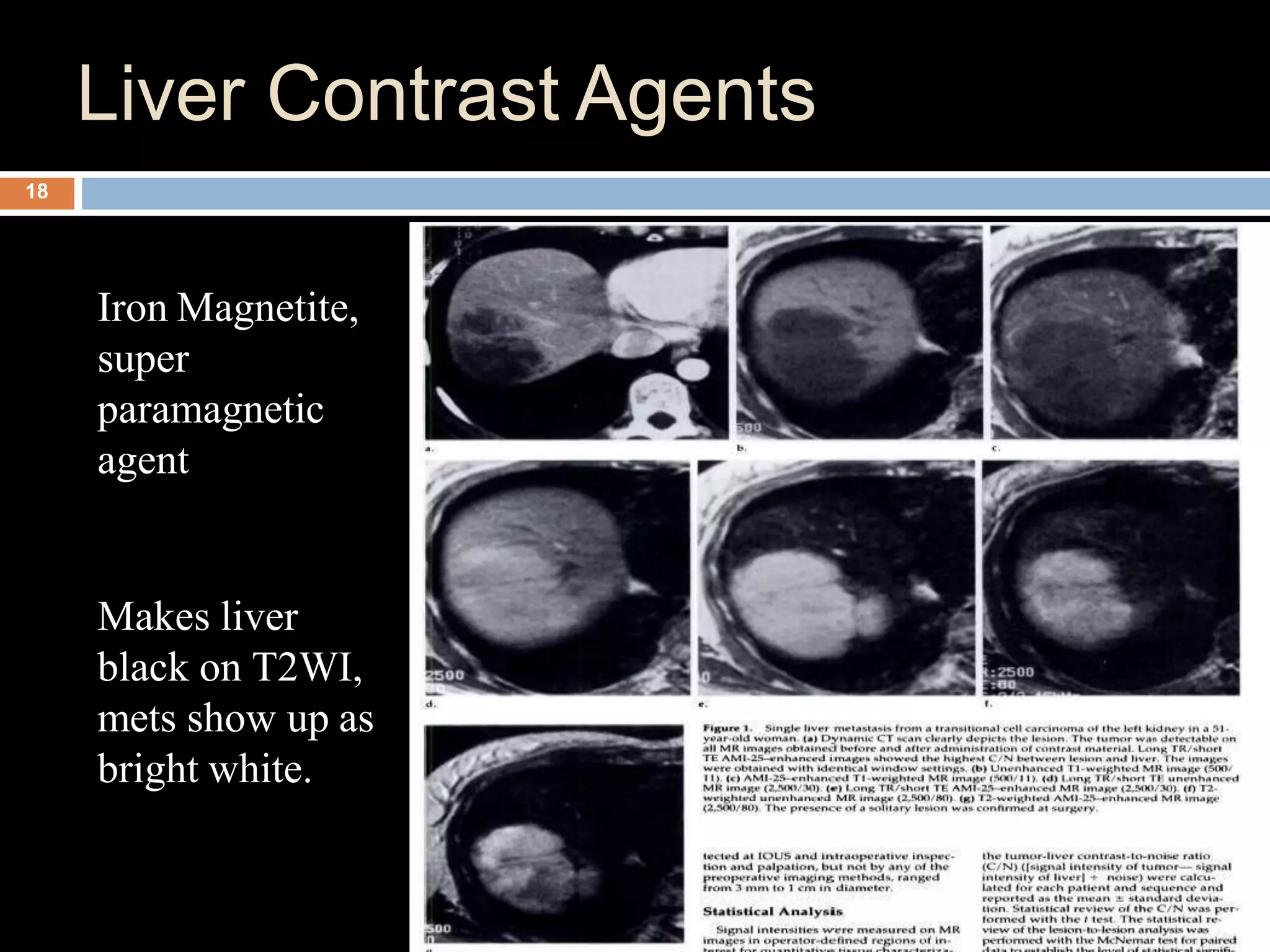 MRI Contrast Agent & Its Principle | PPTX