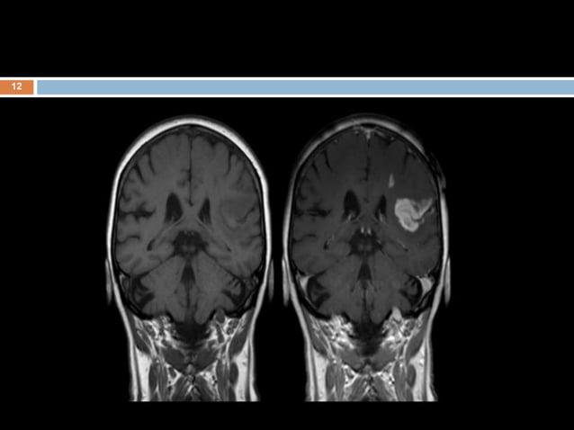 MRI Contrast Agent & Its Principle | PPT