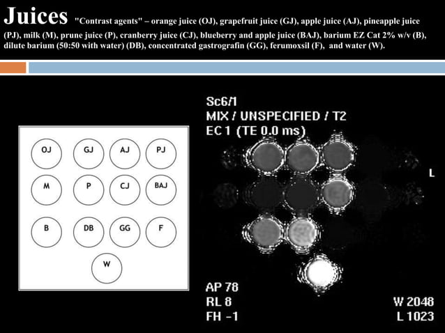 MRI Contrast Agent & Its Principle | PPTX