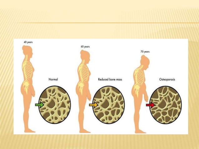 CLINICAL BIOCHEMISTRY OF BONE | PPTX | Bone and Joint Conditions ...