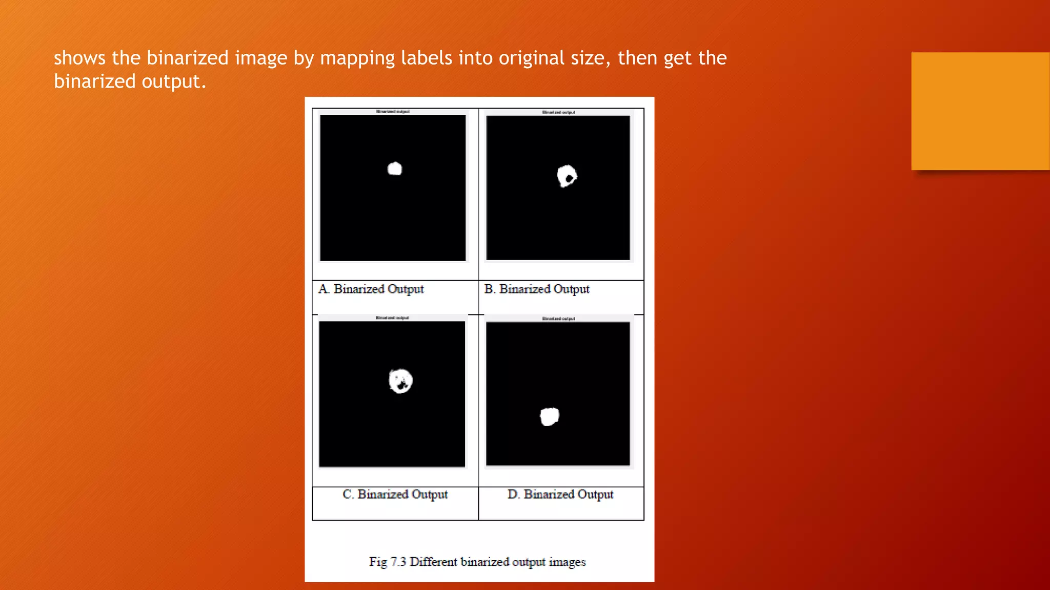 A DEEP LEARNING APPROACH FOR SEMANTIC SEGMENTATION IN BRAIN TUMOR ...