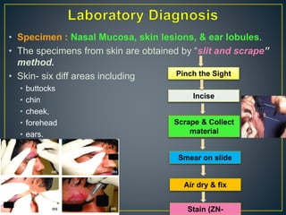 M. leprae.pptx | Infectious Diseases | Diseases and Conditions