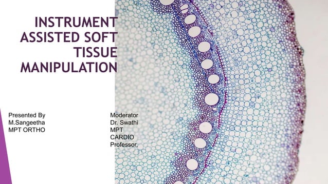 Instrument assisted soft tissue mobilization | PPT | Death, Injury, or ...