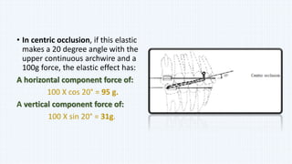 Correction of molar relationship (Elastics) .pptx
