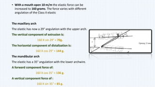 Correction of molar relationship (Elastics) .pptx