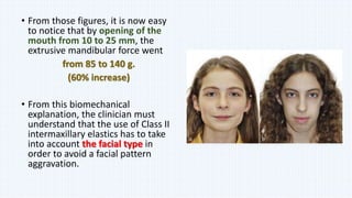Correction of molar relationship (Elastics) .pptx