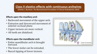Correction of molar relationship (Elastics) .pptx