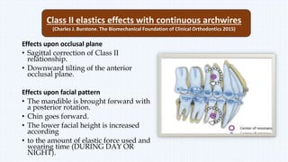 Correction of molar relationship (Elastics) .pptx