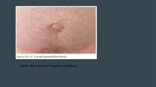 Case presentation abdominal swelling.pptx