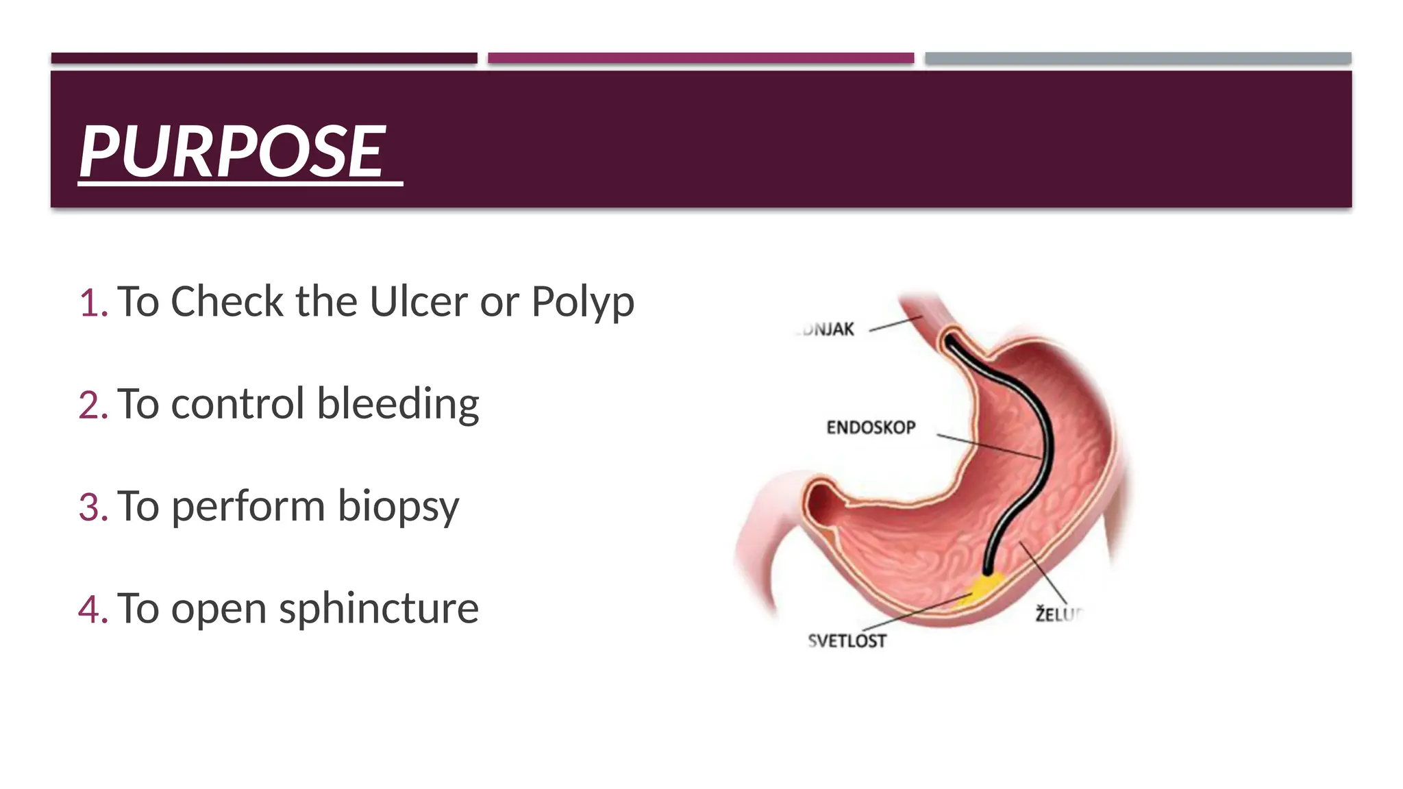 Endoscopy Procedure with upper and lower route | PPTX | Digestive ...