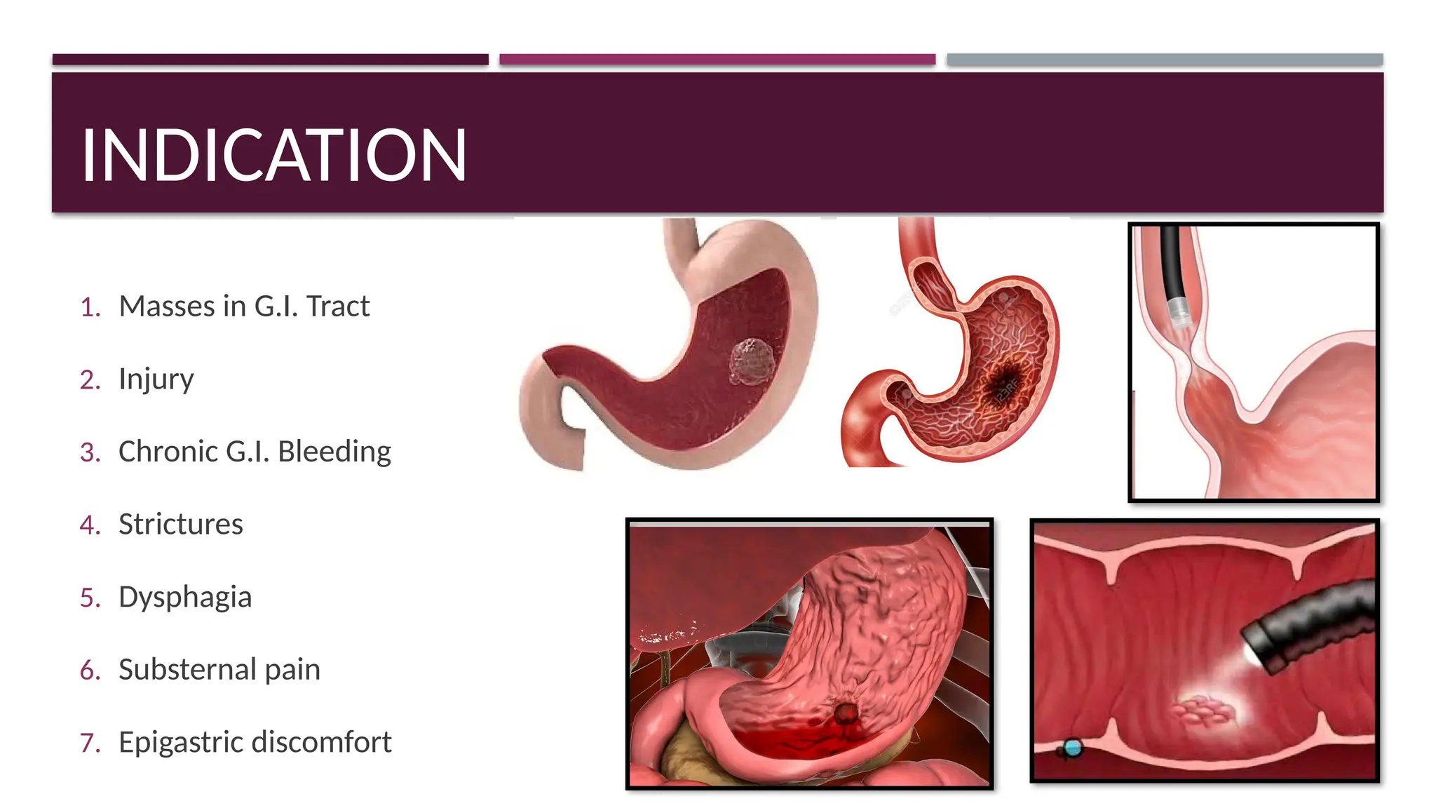 Endoscopy Procedure with upper and lower route | PPTX | Digestive ...