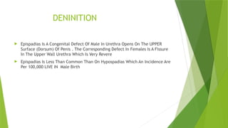 Presentation of hypospadias and epispadias | PPTX