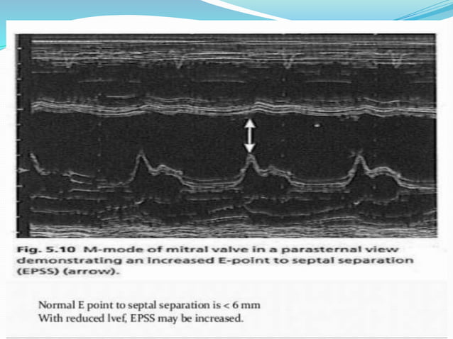M-mode echo-1-1.pptx