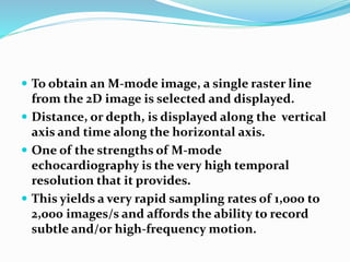 M-mode echo-1-1.pptx