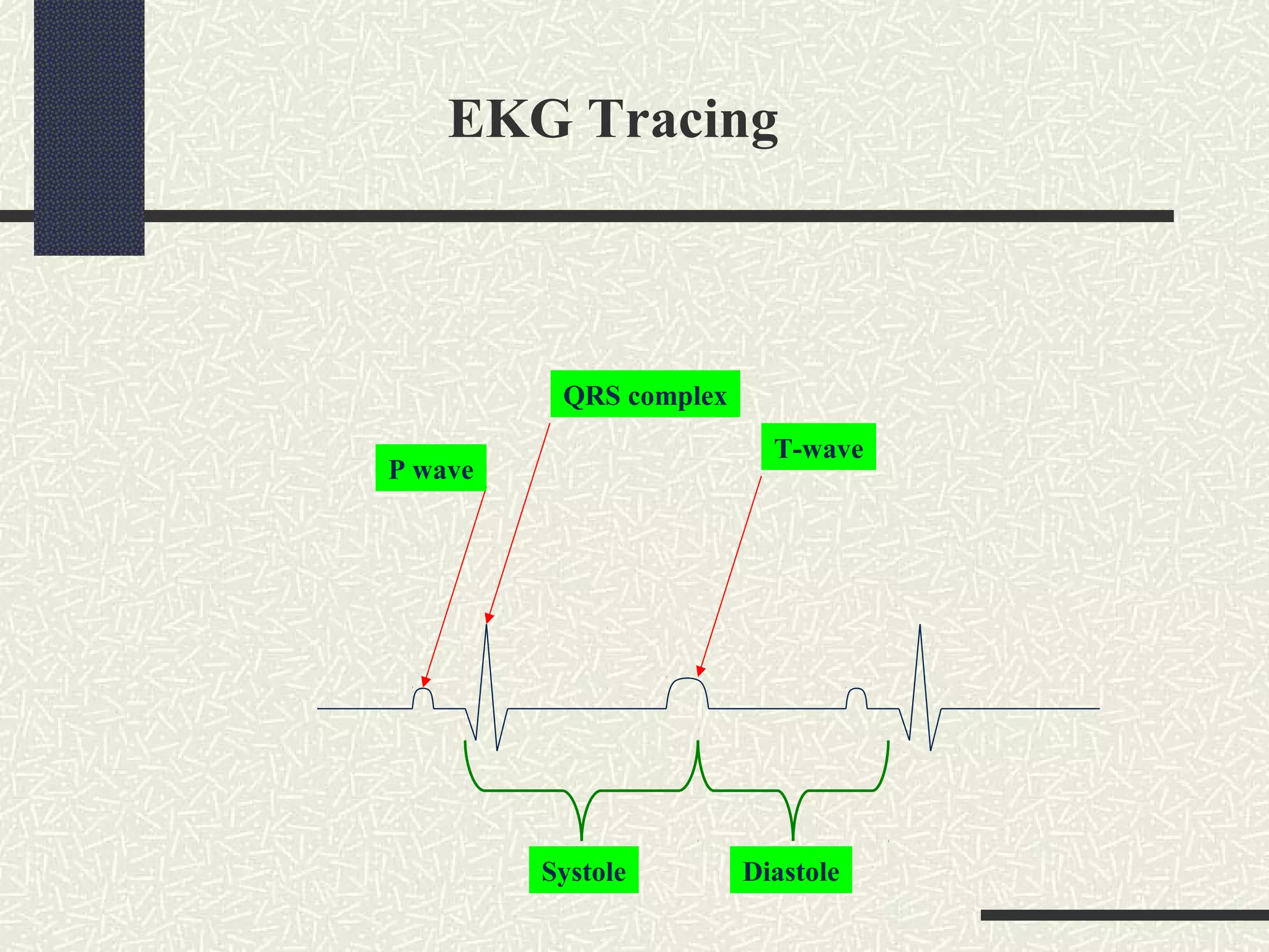 M mode echocardiography | PPT