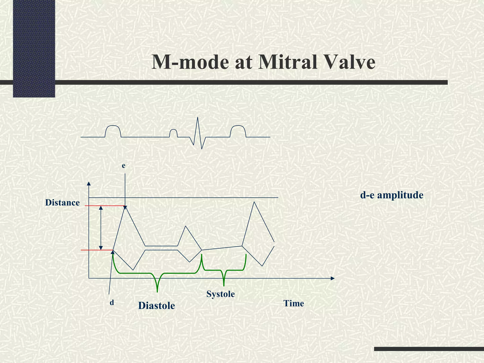 M mode echocardiography | PPT