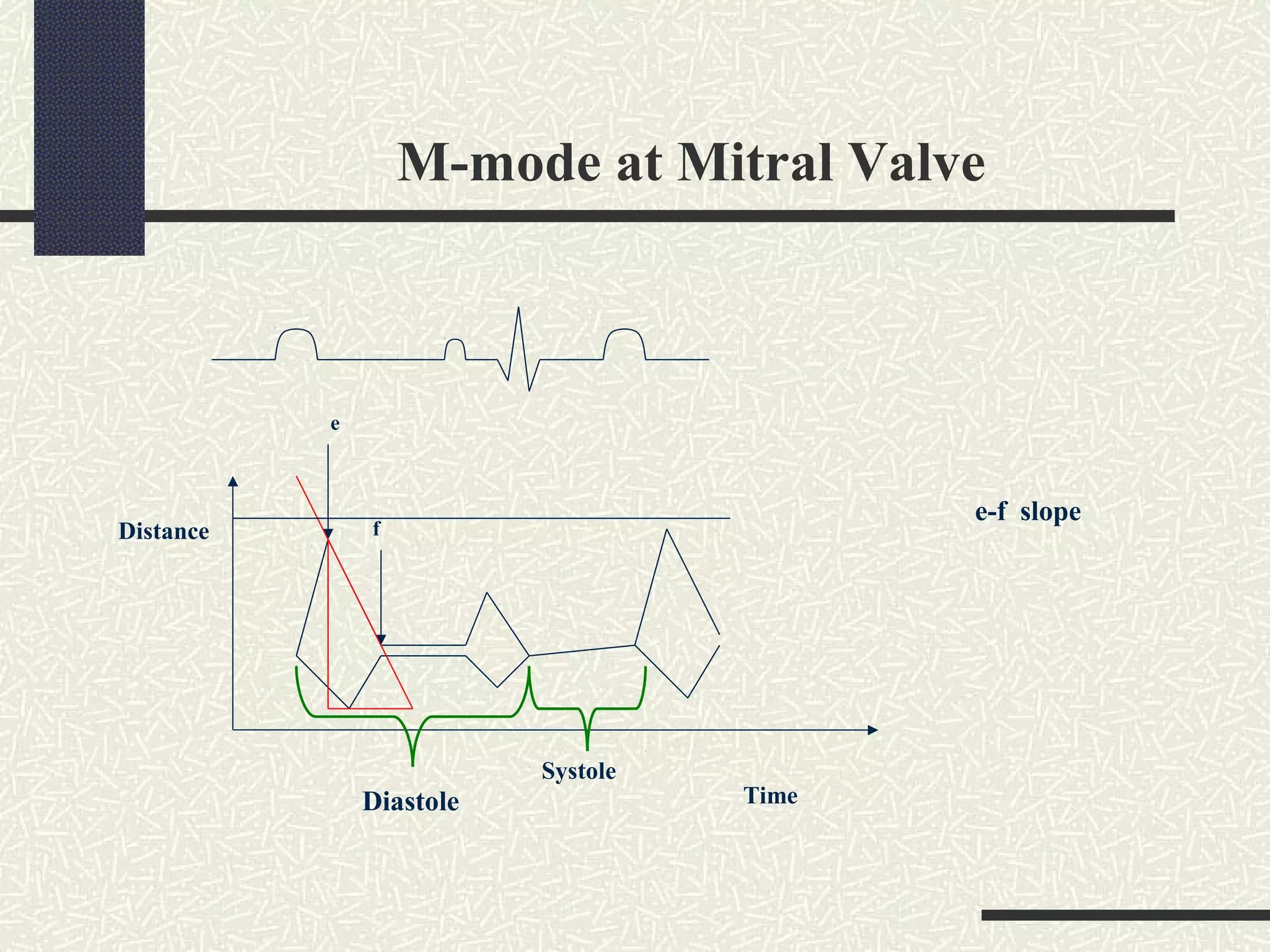 M mode echocardiography | PPT
