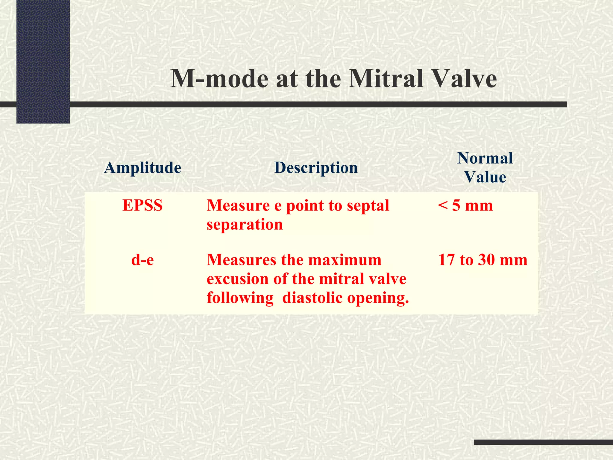 M mode echocardiography | PPT