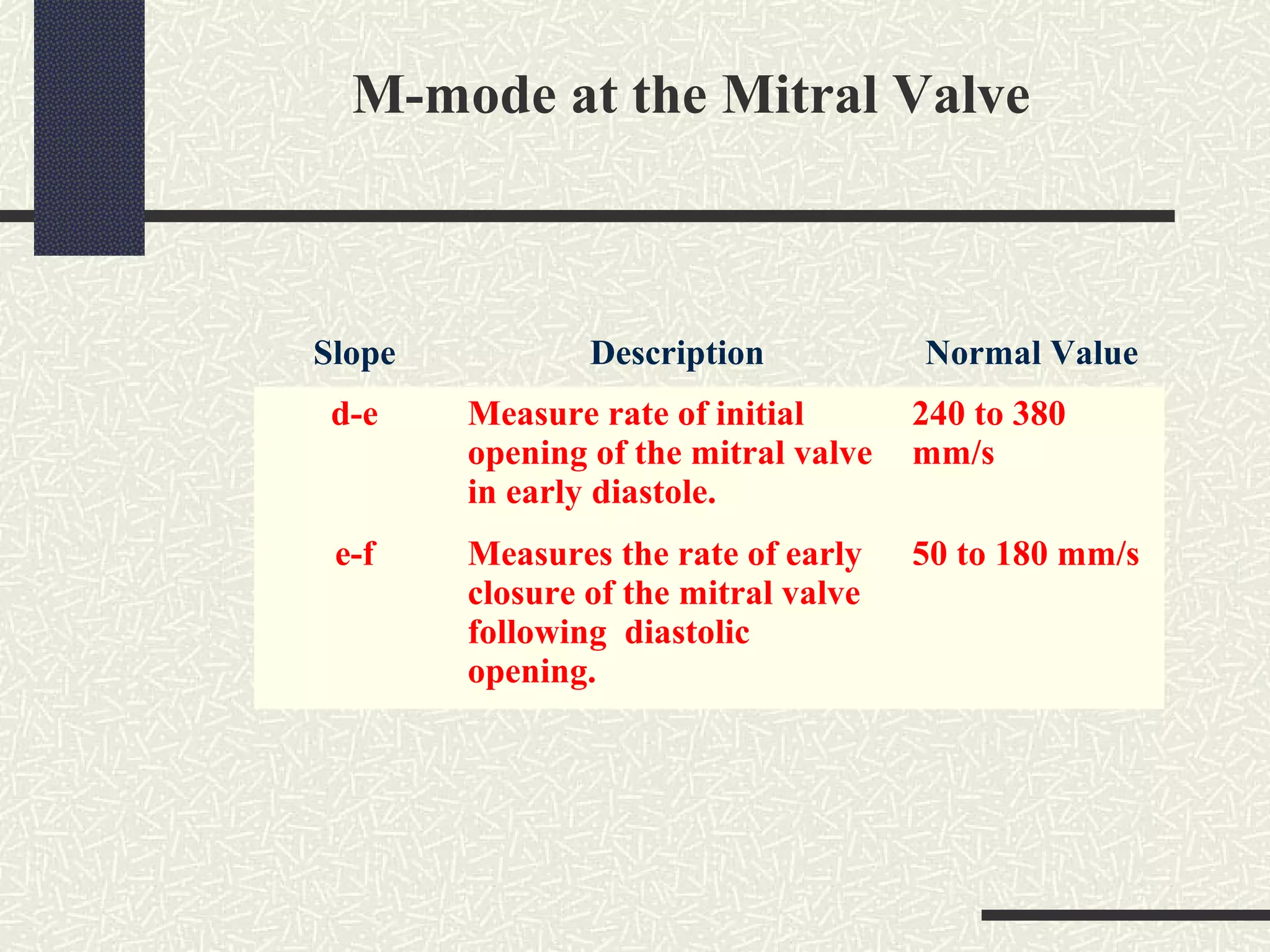 M mode echocardiography | PPT