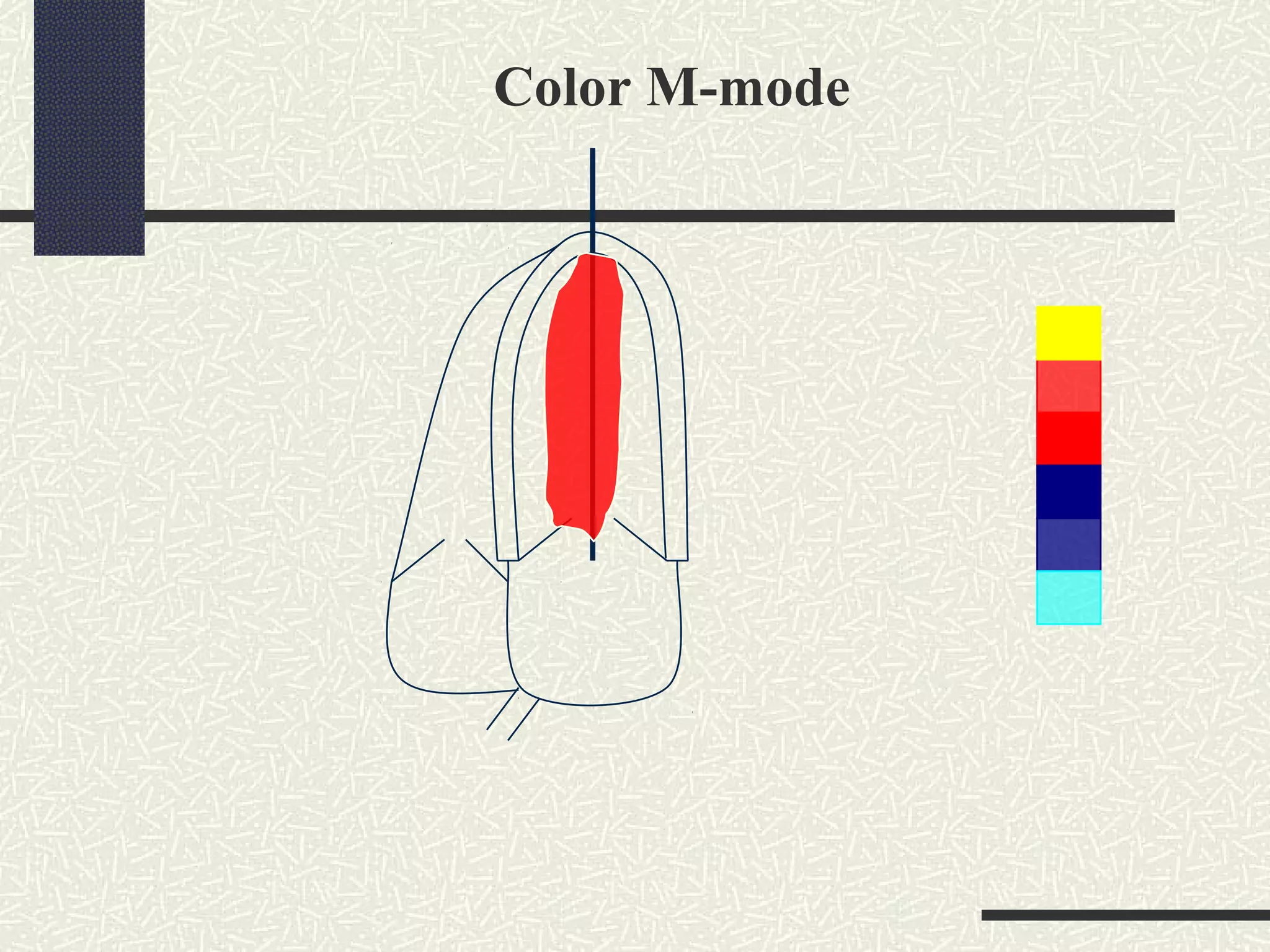 M mode echocardiography | PPT