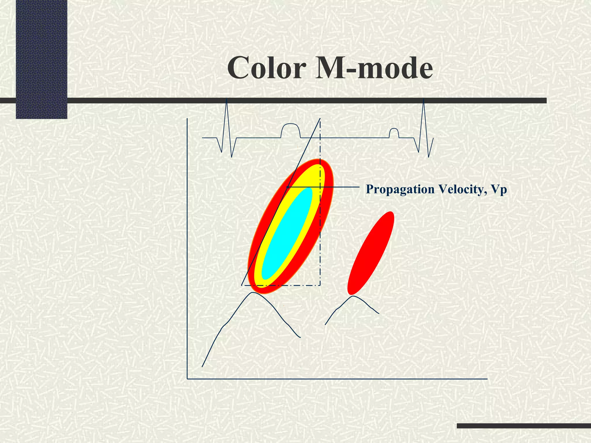 M mode echocardiography | PPT