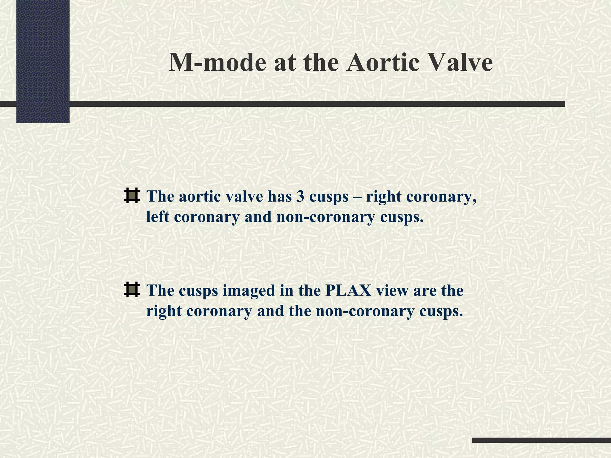 M mode echocardiography | PPT