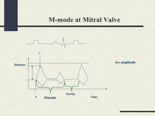 M mode echocardiography | PPT | Heart and Cardiovascular Diseases ...