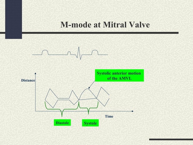 M mode echocardiography | PPT | Heart and Cardiovascular Diseases ...