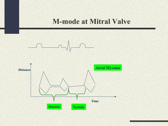 M mode echocardiography | PPT | Heart and Cardiovascular Diseases ...